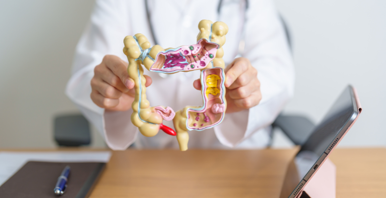 Incidência do cancro colorretal aumentou 80 % nas pessoas com menos de ...